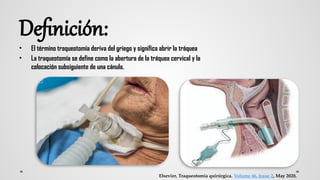 TRAQUEOTOMÍA procedimiento quirúrgico pptx | PPTX