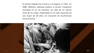 Historia del primer trasplante en el mundo desde el inicio al fin. | PDF