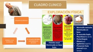 Trastornos Pleurales | PPTX