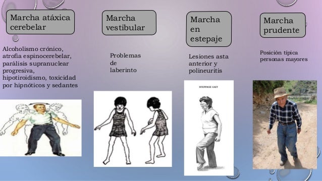 Trastornos de-la-marcha-y-caidas