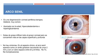 Trastornos corneales degenerativos | PPTX