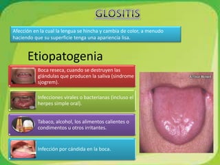Trastornos de la boca y de la lengua completo | PPTX