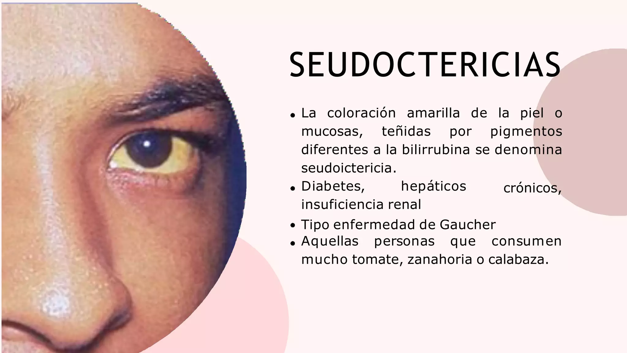TRASTORNOS DE LA COLORACIÓN DE LA PIEL. ICTERICIA, CIANOSIS Y EDEMA ...
