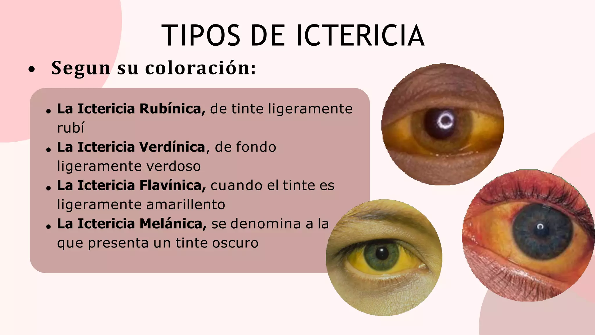 TRASTORNOS DE LA COLORACIÓN DE LA PIEL. ICTERICIA, CIANOSIS Y EDEMA ...