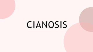 TRASTORNOS DE LA COLORACIÓN DE LA PIEL. ICTERICIA, CIANOSIS Y EDEMA.pptx
