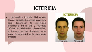 TRASTORNOS DE LA COLORACIÓN DE LA PIEL. ICTERICIA, CIANOSIS Y EDEMA.pptx