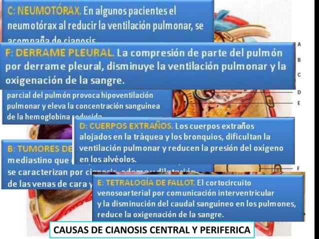 Trastornos de la coloracion y edema | PPTX