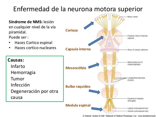 Trastornos De La Neurona Motora