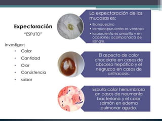 expectoracion | PPTX