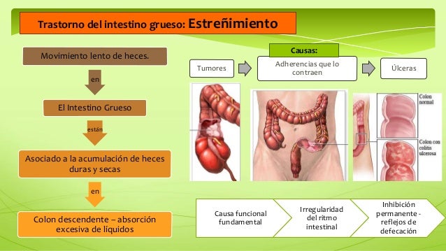 Trastornos del intestino grueso