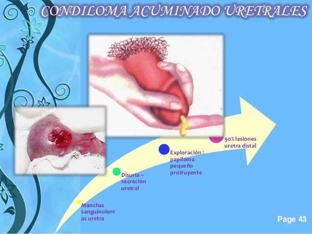 Trastornos del pene y uretra 1
