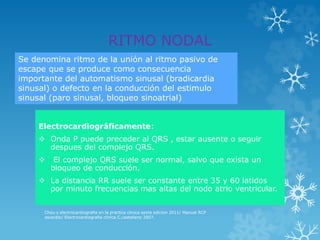 Trastornos del ritmo cardíaco | PPTX