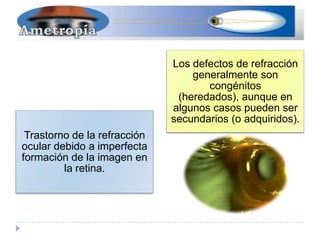 Trastornos de Refracción Ocular | PPTX
