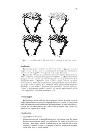 Trastornos hemodinamicos | PDF