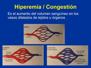 Trastornos Hemodinamicos | PPT