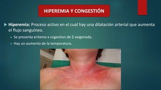 Trastornos hemodinamicosclasse | PPTX