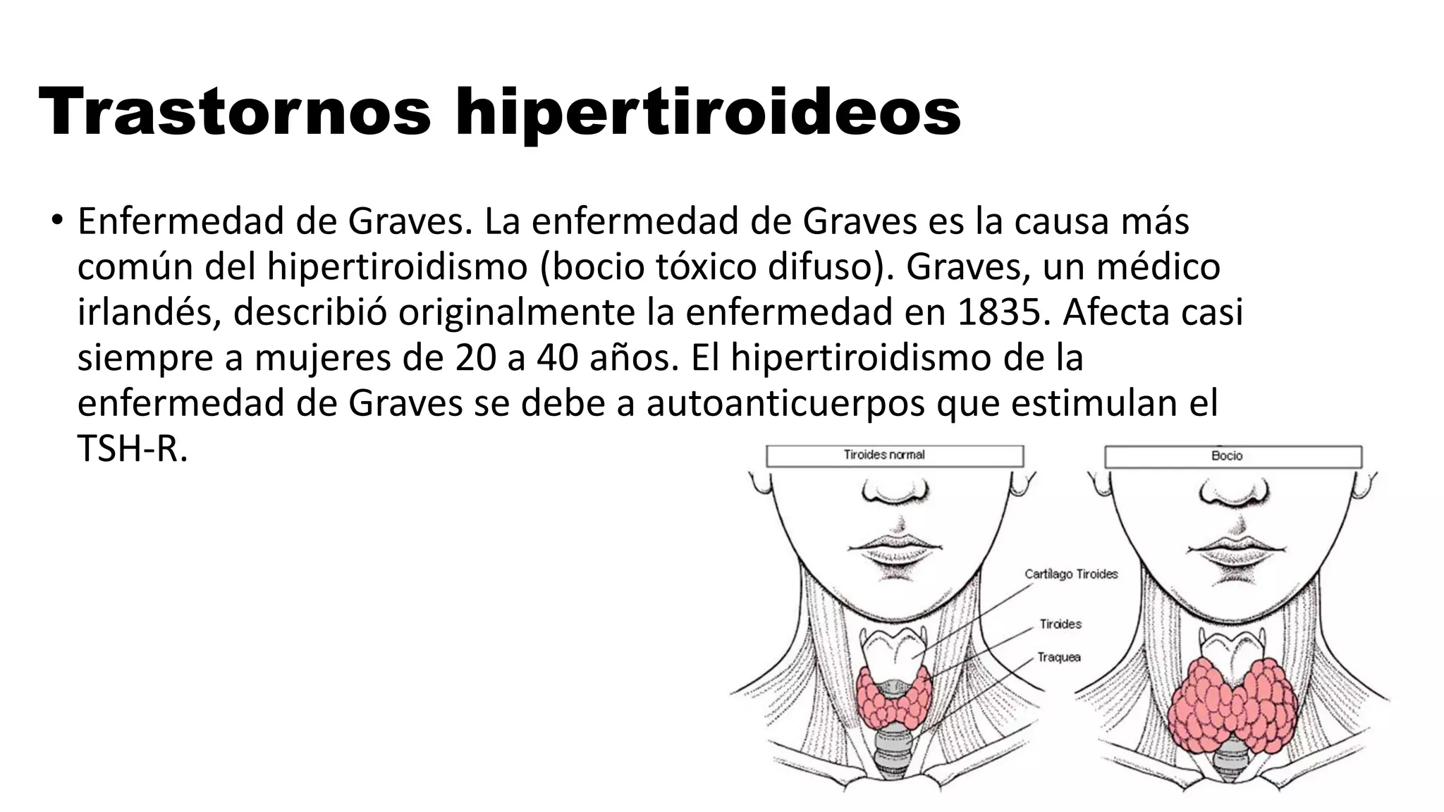 Trastornos paratiroideos Ucne | PPTX