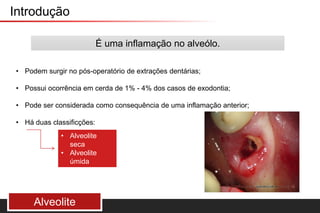 Tratamento alveolites, pericoronarites e hemorragias | PDF
