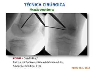 Tratamento da instabilidade patelofemoral em crianças | PPTX