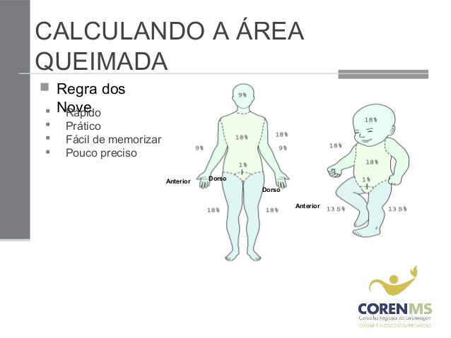 Tratamento Emergencial em Queimaduras - Enf. Cida Amaral