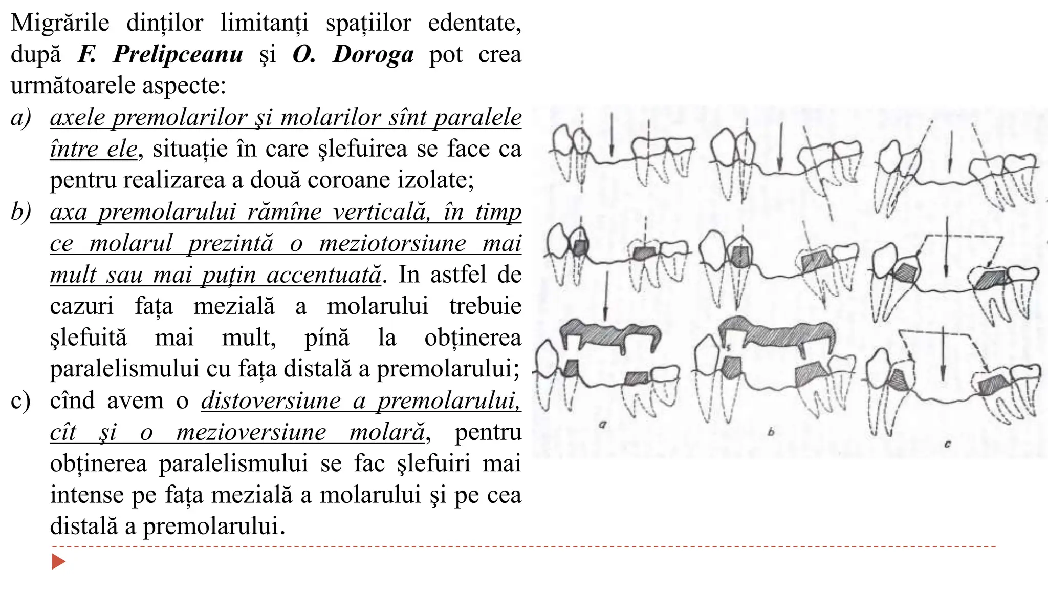 Tratamentul-ortopedic-al-pacienților-cu-migr.pptx
