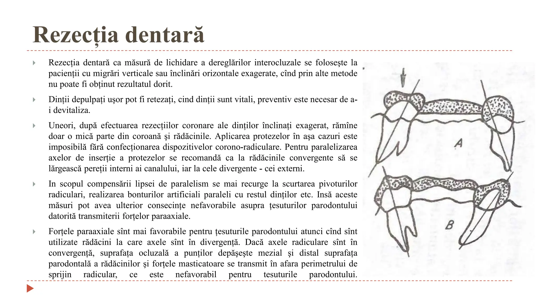 Tratamentul-ortopedic-al-pacienților-cu-migr.pptx