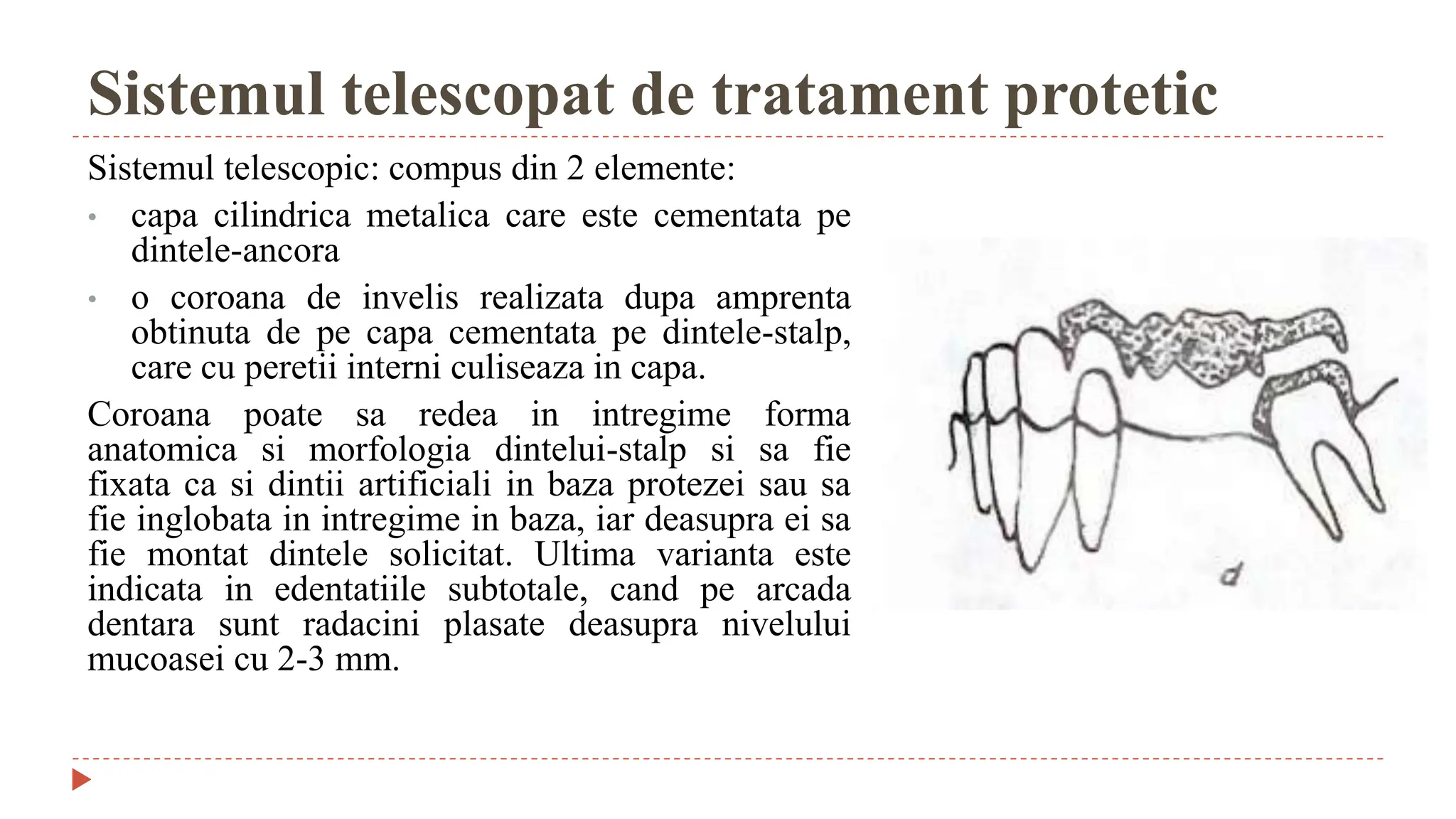 Tratamentul-ortopedic-al-pacienților-cu-migr.pptx