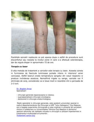 Ce sunt varicele? Metode de tratament ale varicelor | PDF