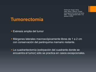 Tratamiento cancer de mama in situ | PPT