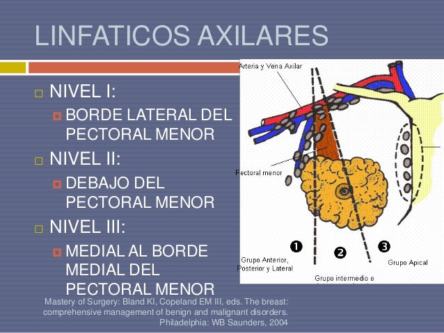 Tratamiento de ca de mama