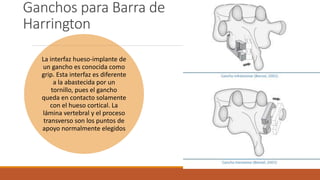 Tratamiento de fracturas columna torácico lumbar | PPTX