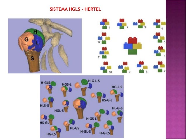 Tratamiento de las fracturas del tercio proximal de humero DR ARTEAGA…
