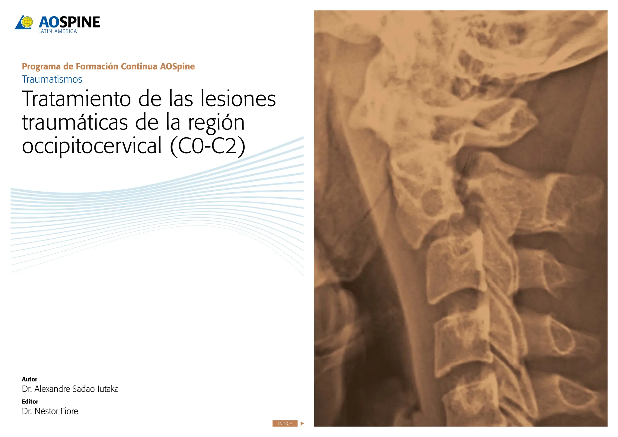 Tratamiento de las lesiones traumáticas de la región occipito cervical.pdf