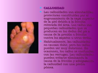 Tratamiento de los pies | PPT