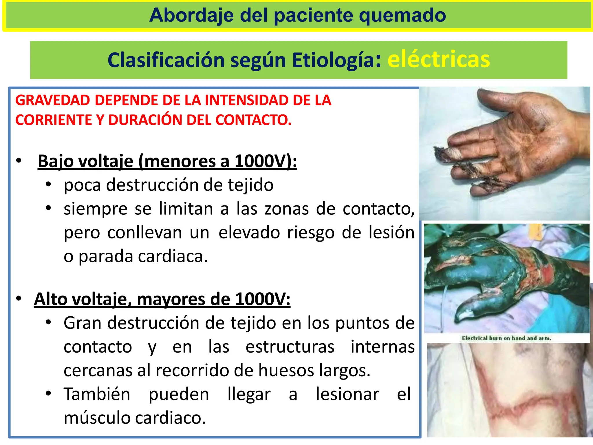 tratamiento de quemaduras protocolo .pptx