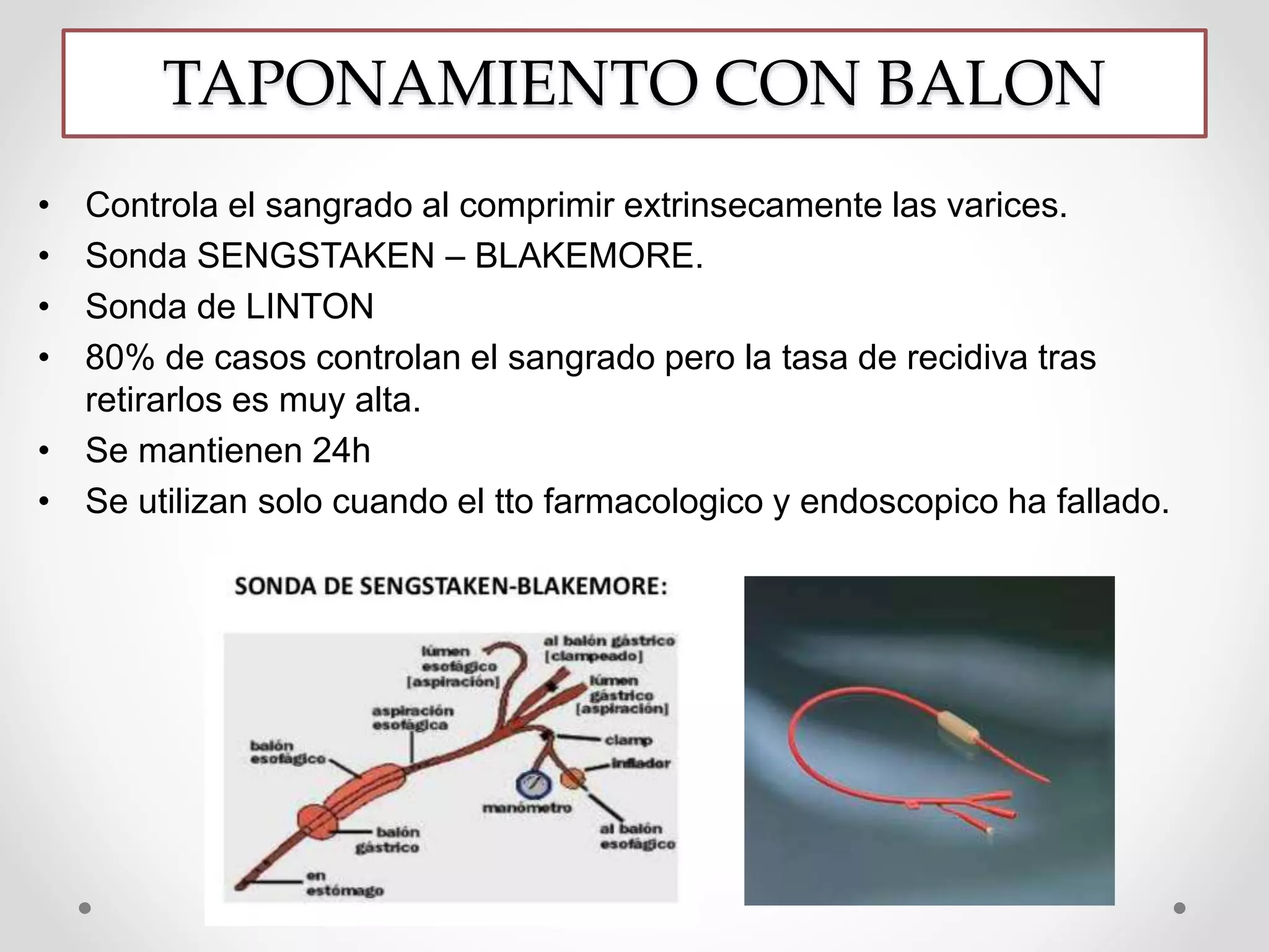 Tratamiento de varices esofagicas 2016 | PPT