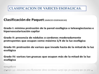 Tratamiento de varices esofagicas 2016 | PPTX