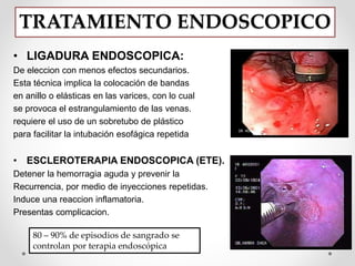 Tratamiento de varices esofagicas 2016 | PPTX