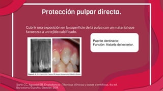 Tratamiento en dientes con apice inmaduro (3).pptx