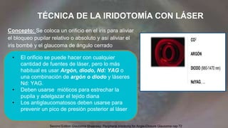 TRATAMIENTO LÁSER DEL GLAUCOMA.pptx