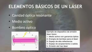 TRATAMIENTO LÁSER DEL GLAUCOMA.pptx