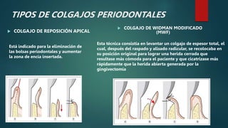 TRATAMIENTO PERIODONTAL QUIRURGICO 02.pptx