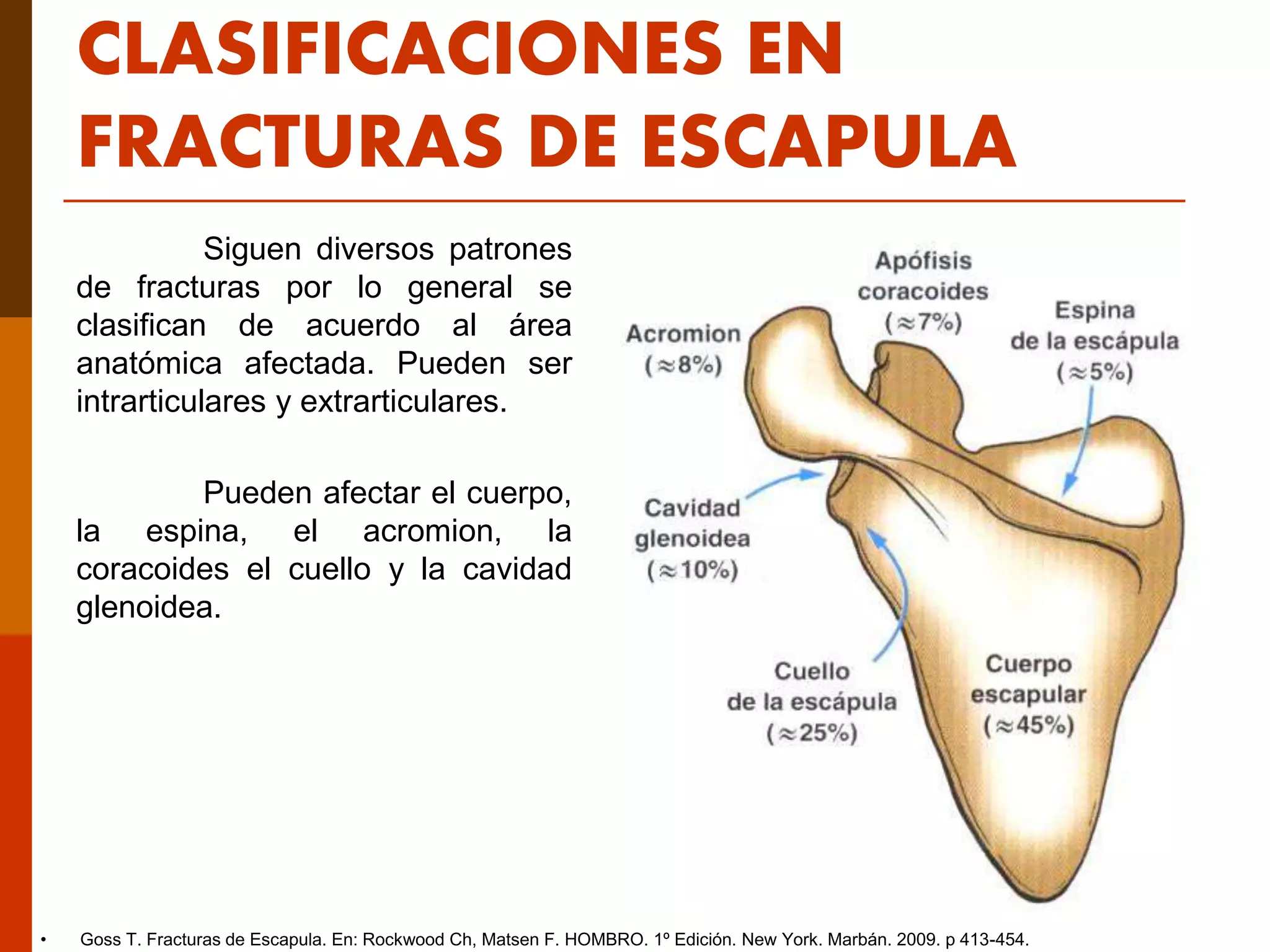 tratamiento de fracturas de escapula | PDF