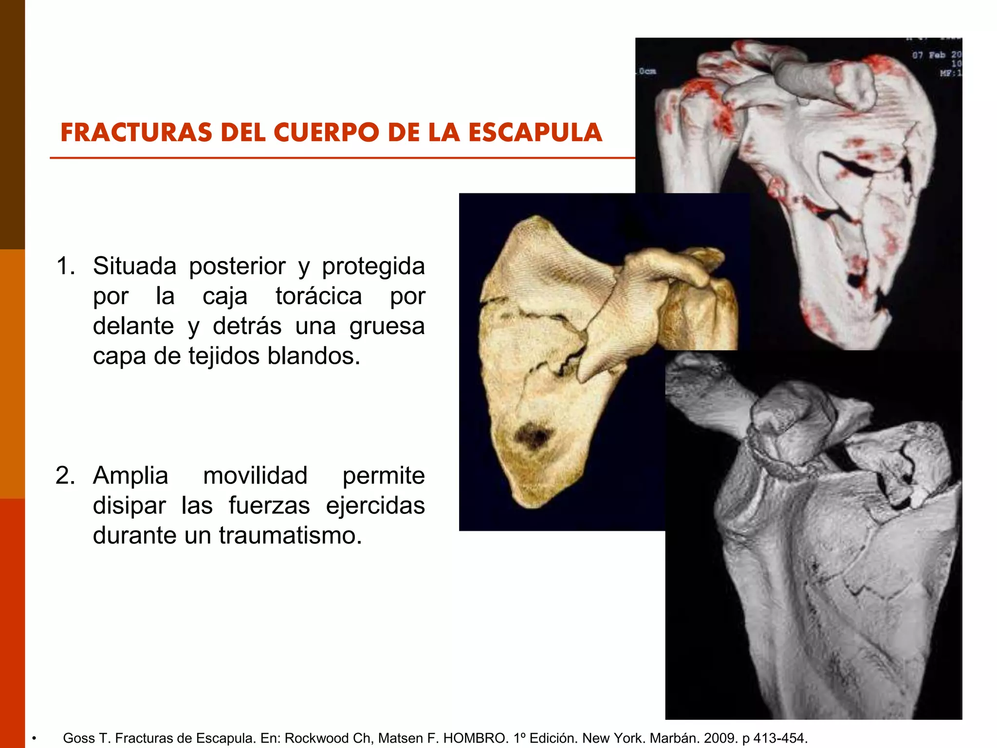 tratamiento de fracturas de escapula | PDF