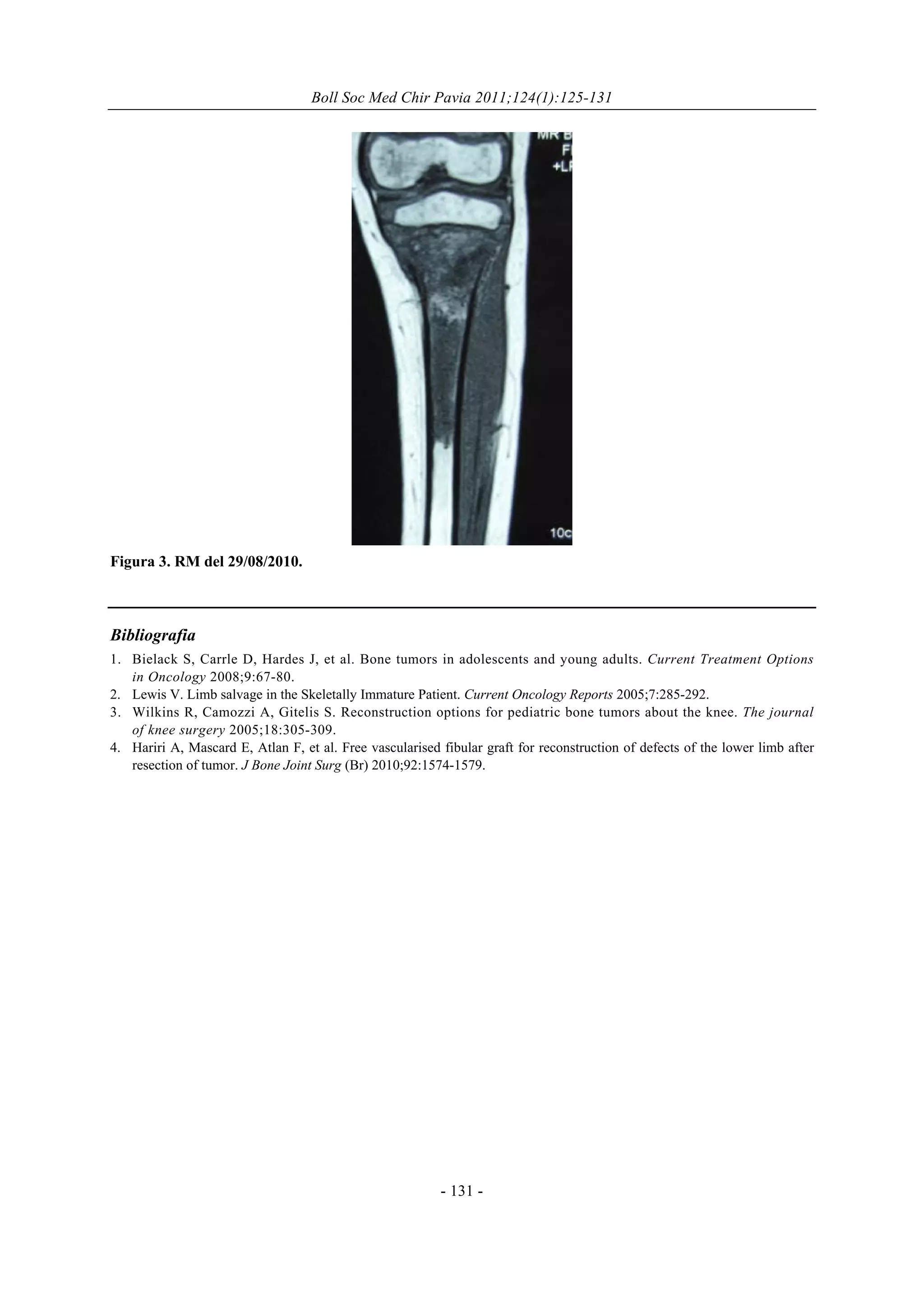 Trattamento medico e chirurgico dell’osteosarcoma prossimale di tibia ...