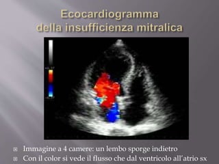 Trattamento valvulopatie e medico di famiglia | PPTX