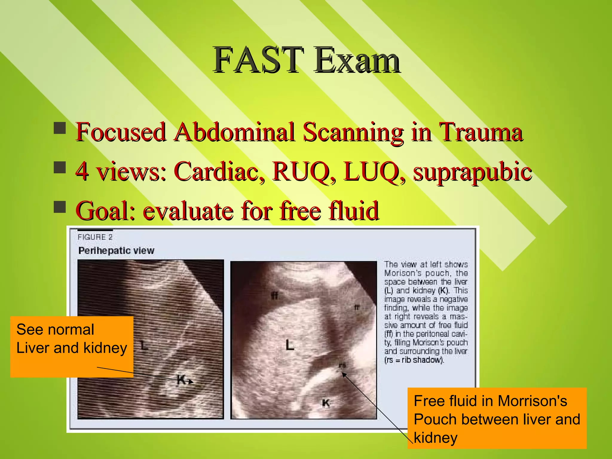 Trauma | PPT