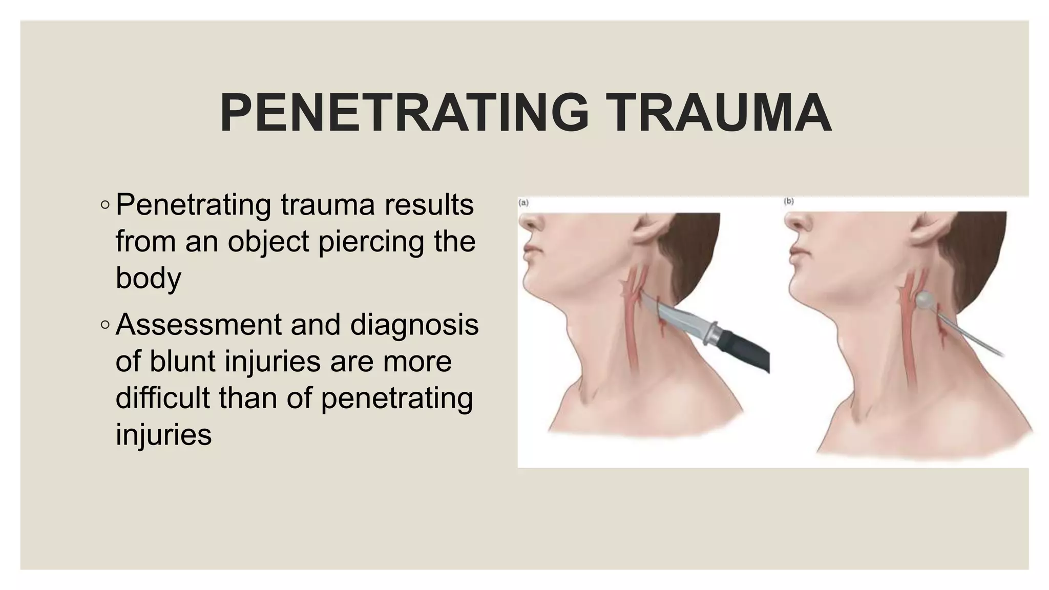 Trauma Nursing | PPTX