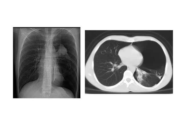 Diagnostic Imaging of Chest Trauma | PPT