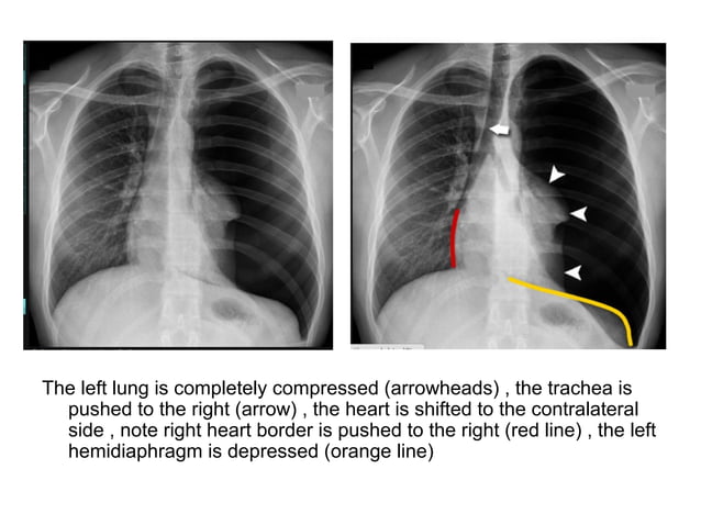Diagnostic Imaging of Chest Trauma | PPT